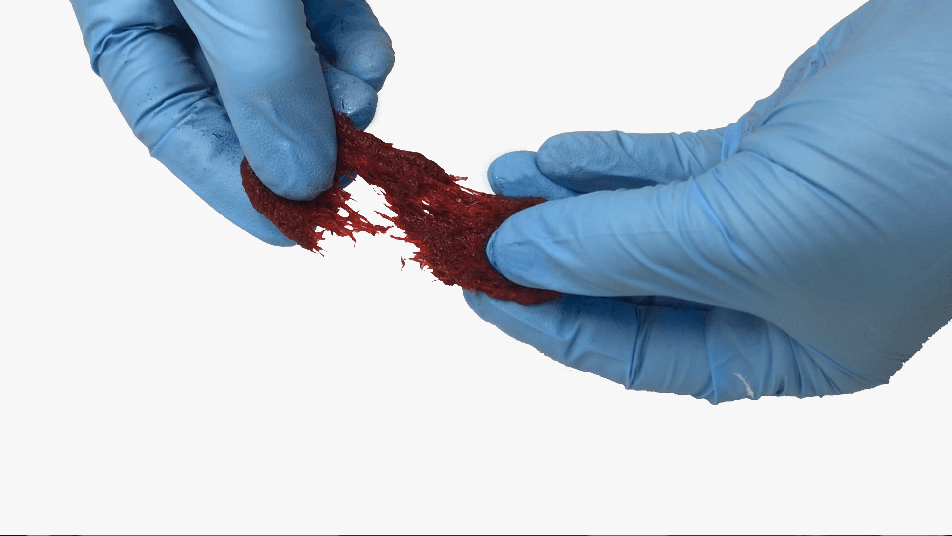 AlphaGRAFT - ATEC Spine