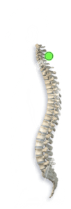 PCF - ATEC Spine