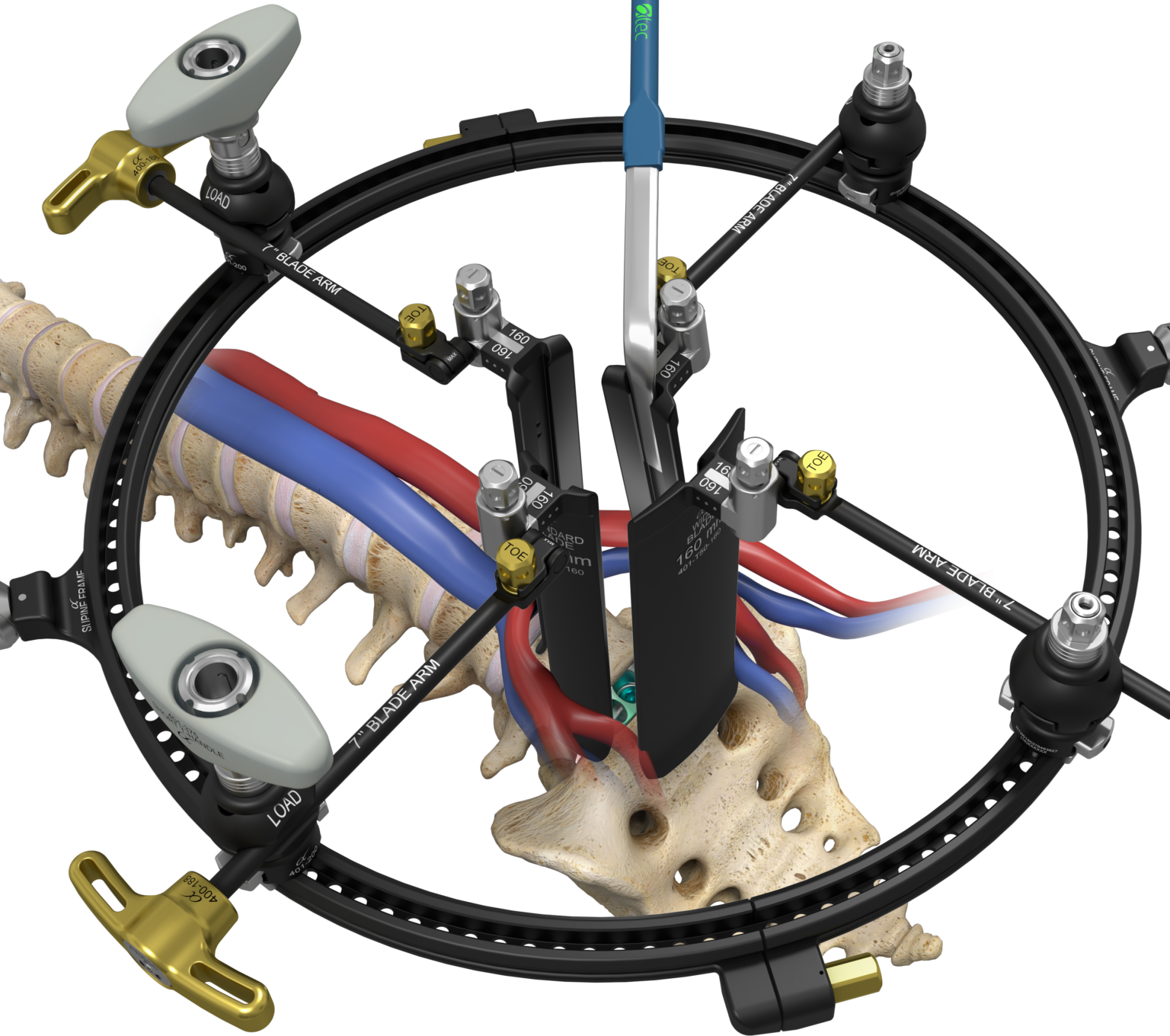Anterior Lumbar Interbody Fusion (ALIF) - ATEC Spine